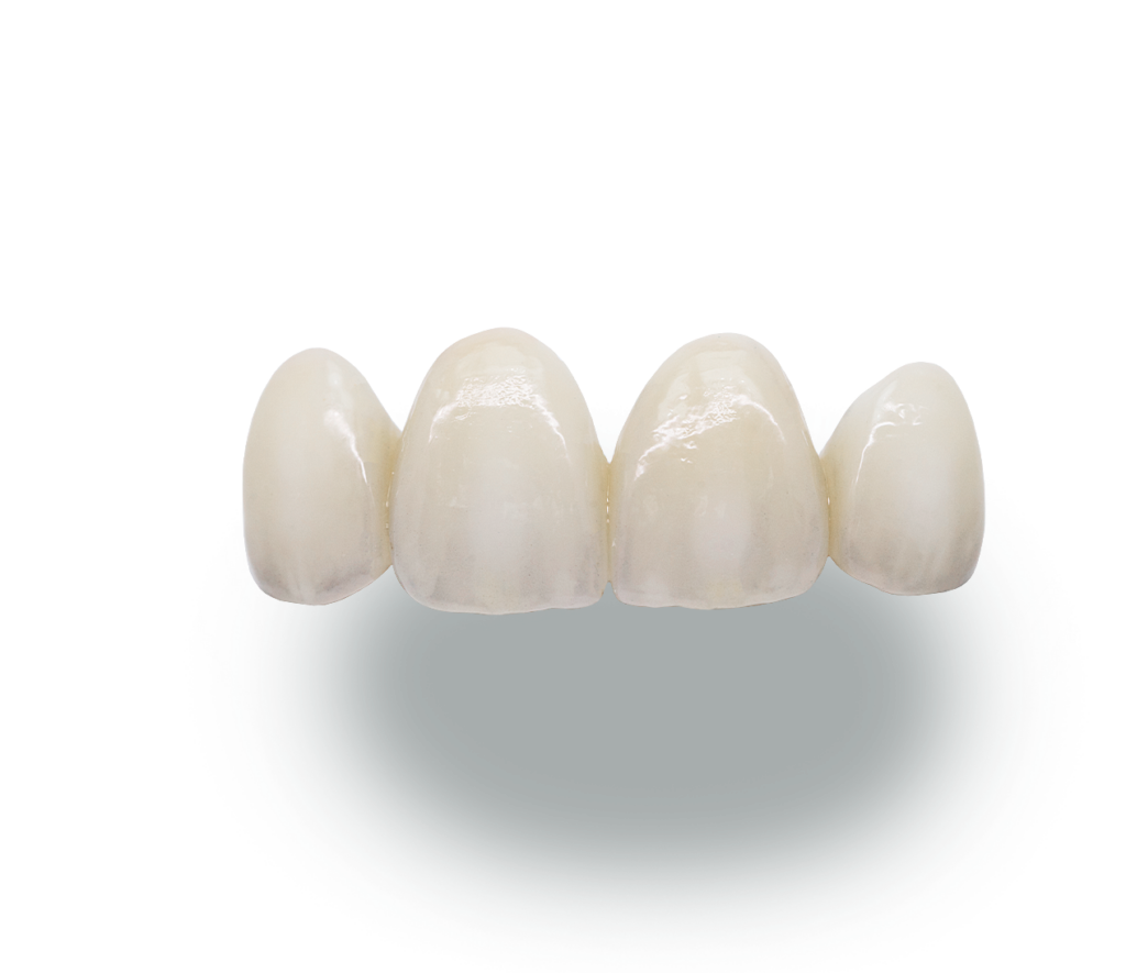Crowns & Bridges - Drake Dental Lab