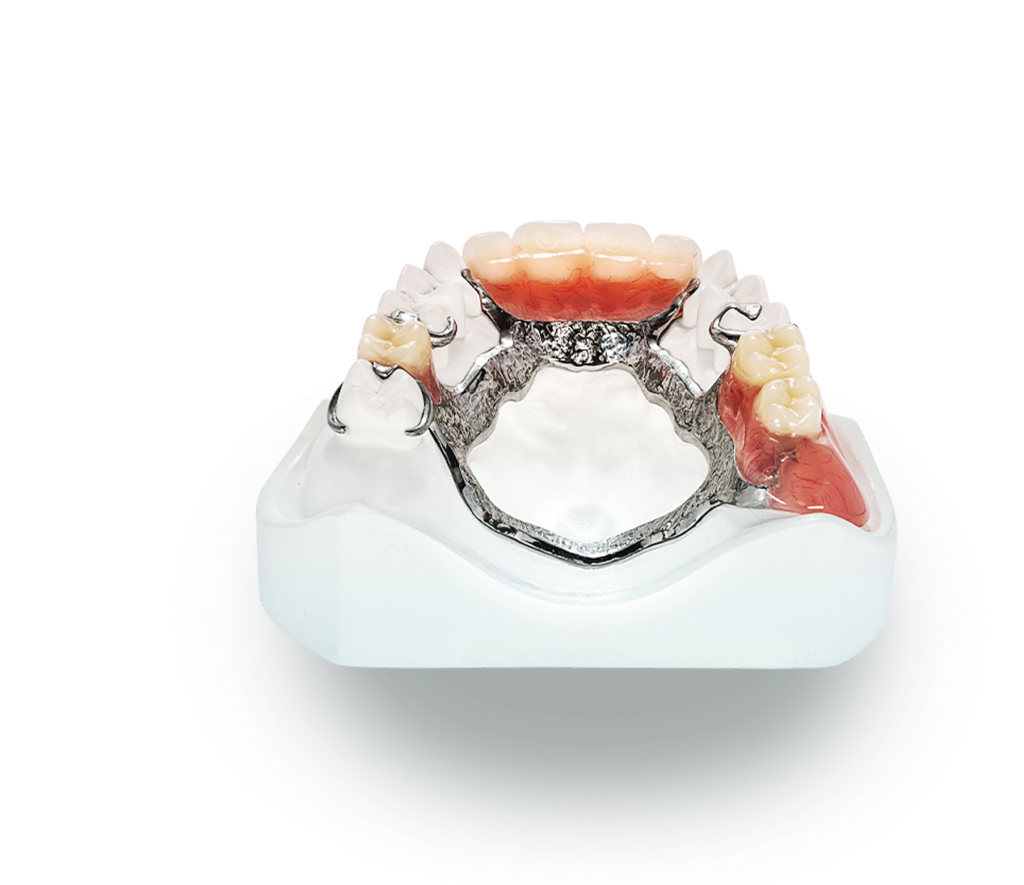 Partials - Drake Dental Lab